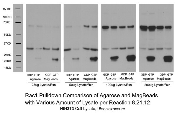 Rac1/cdc42 Activation Magnetic Beads Pulldown Assay | 17-10394